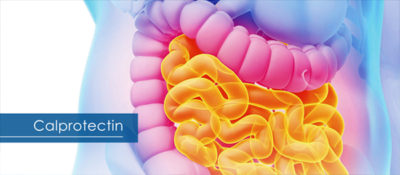This month, let’s talk about Calprotectin - Certest Biotec - Raw ...